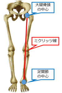 ミクリッツ線（Mikulicz line）の正常は？測定方法を解説！ - 白衣のドカタ